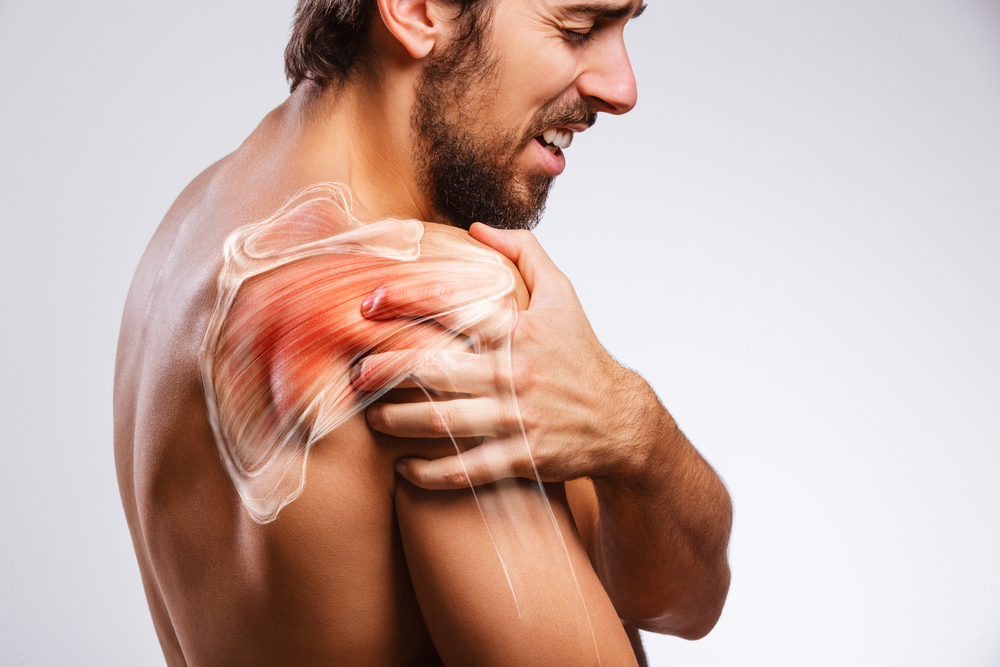 Tendinite calcária do ombro: sintomas e tratamento - Dr. Rodolpho Scalize